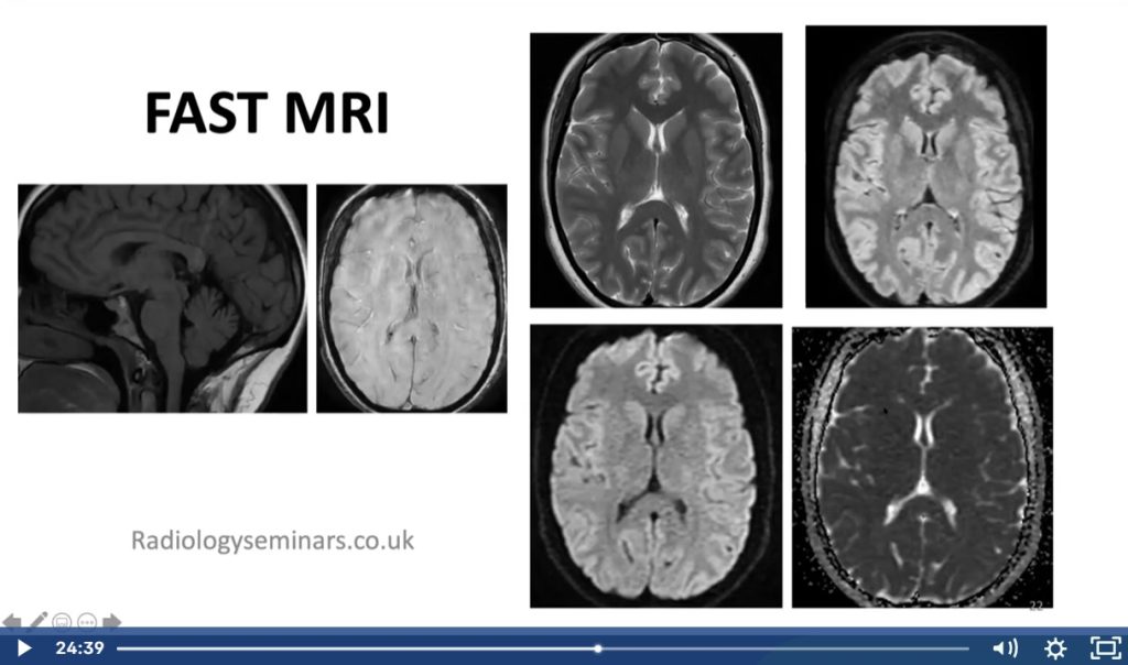 MRI Brain Online Course | Radiology Seminars | MedCourse